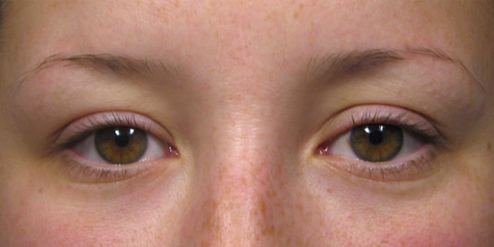 Photo Gallery | De Novo Permanent Cosmetics